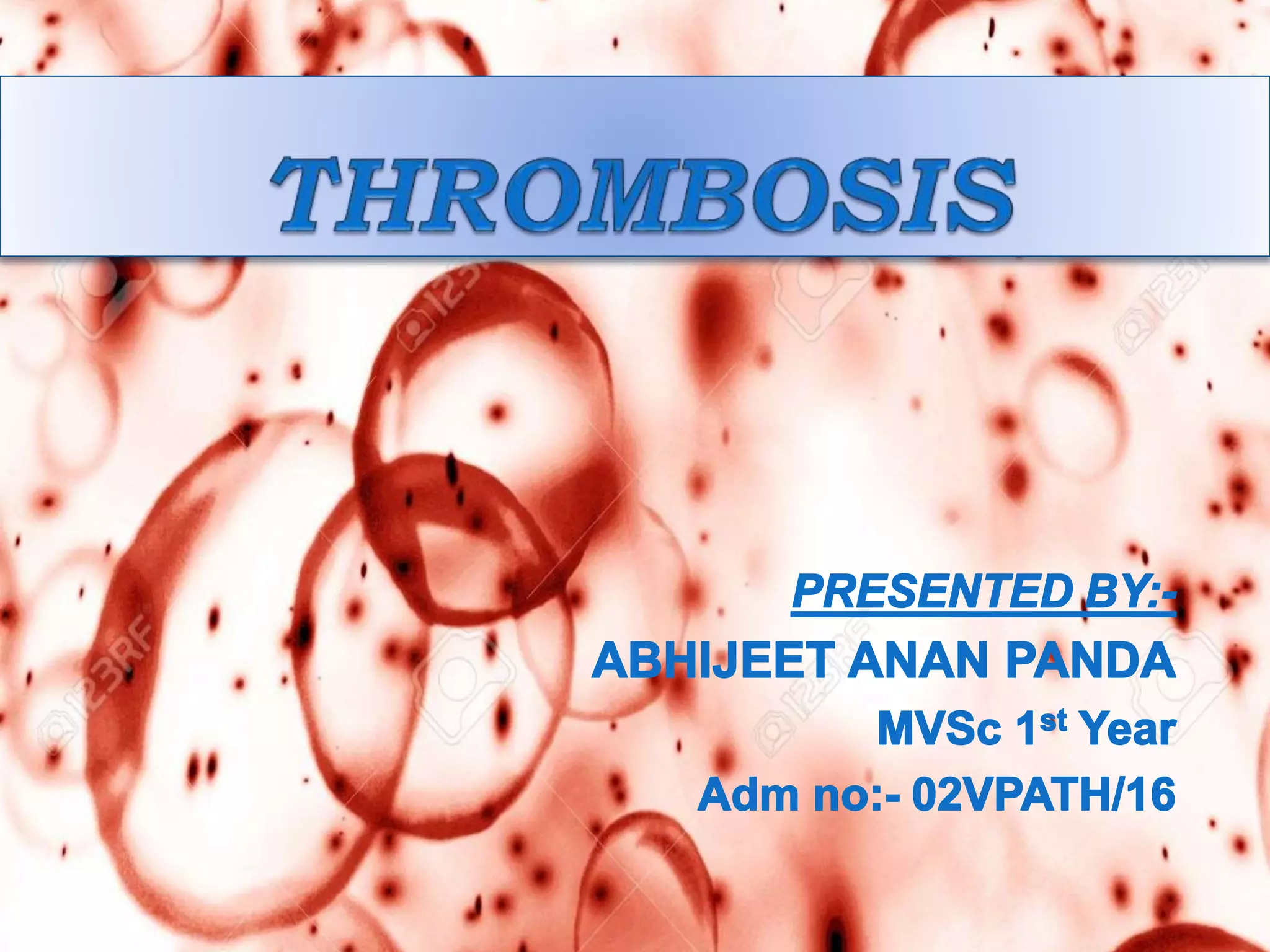 Thrombosis | PPTX