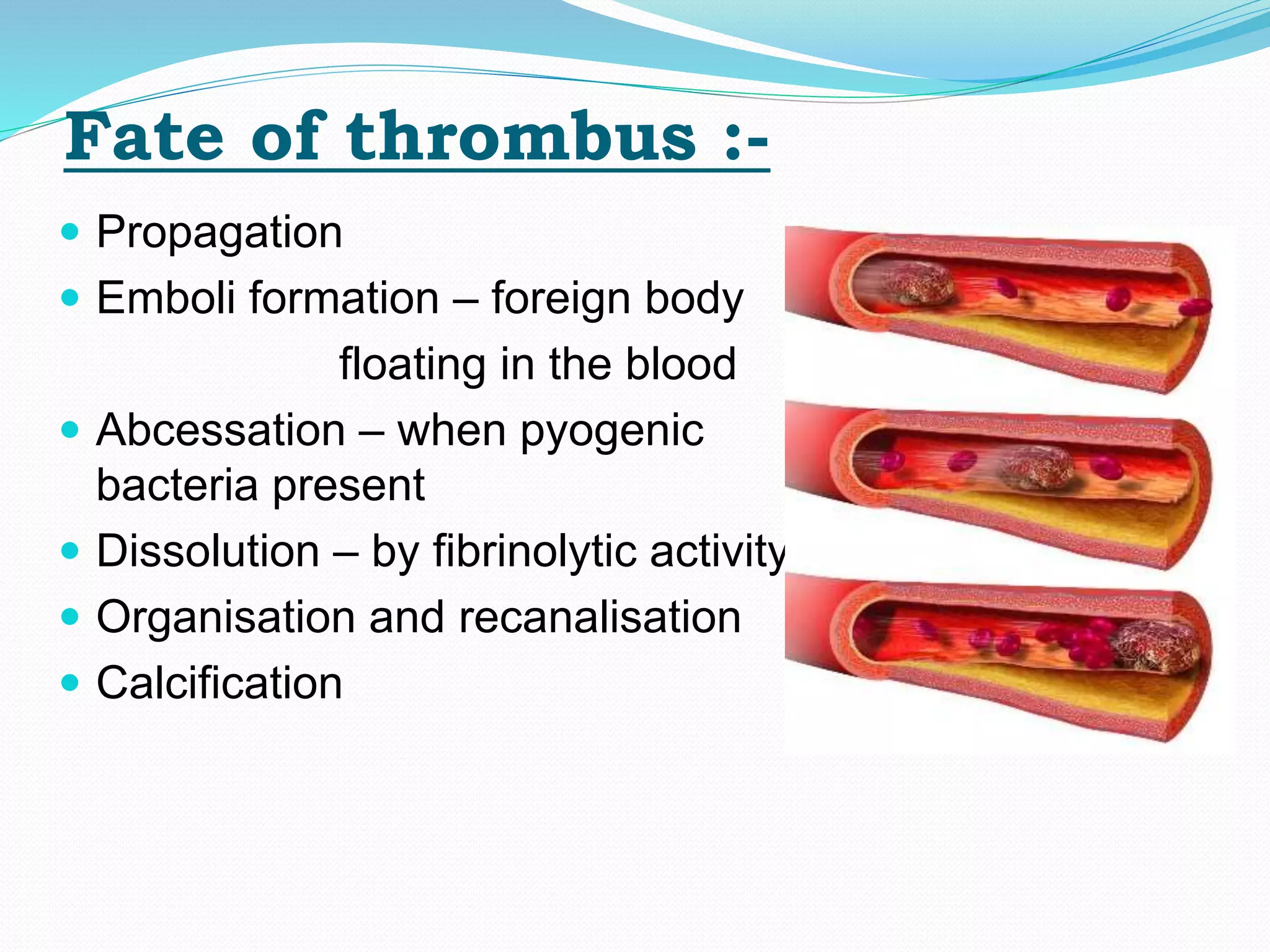 Thrombosis | PPTX