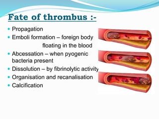 Thrombosis | PPTX