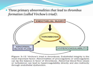 Thrombosis | PPTX