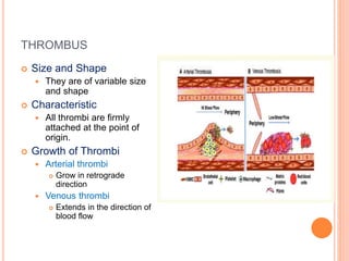 Thrombosis | PPTX