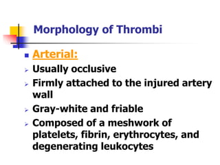 Thrombosis.ppt