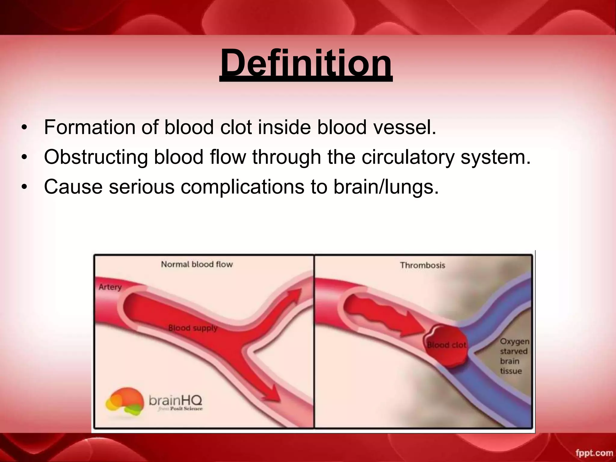 thrombosis.pptx