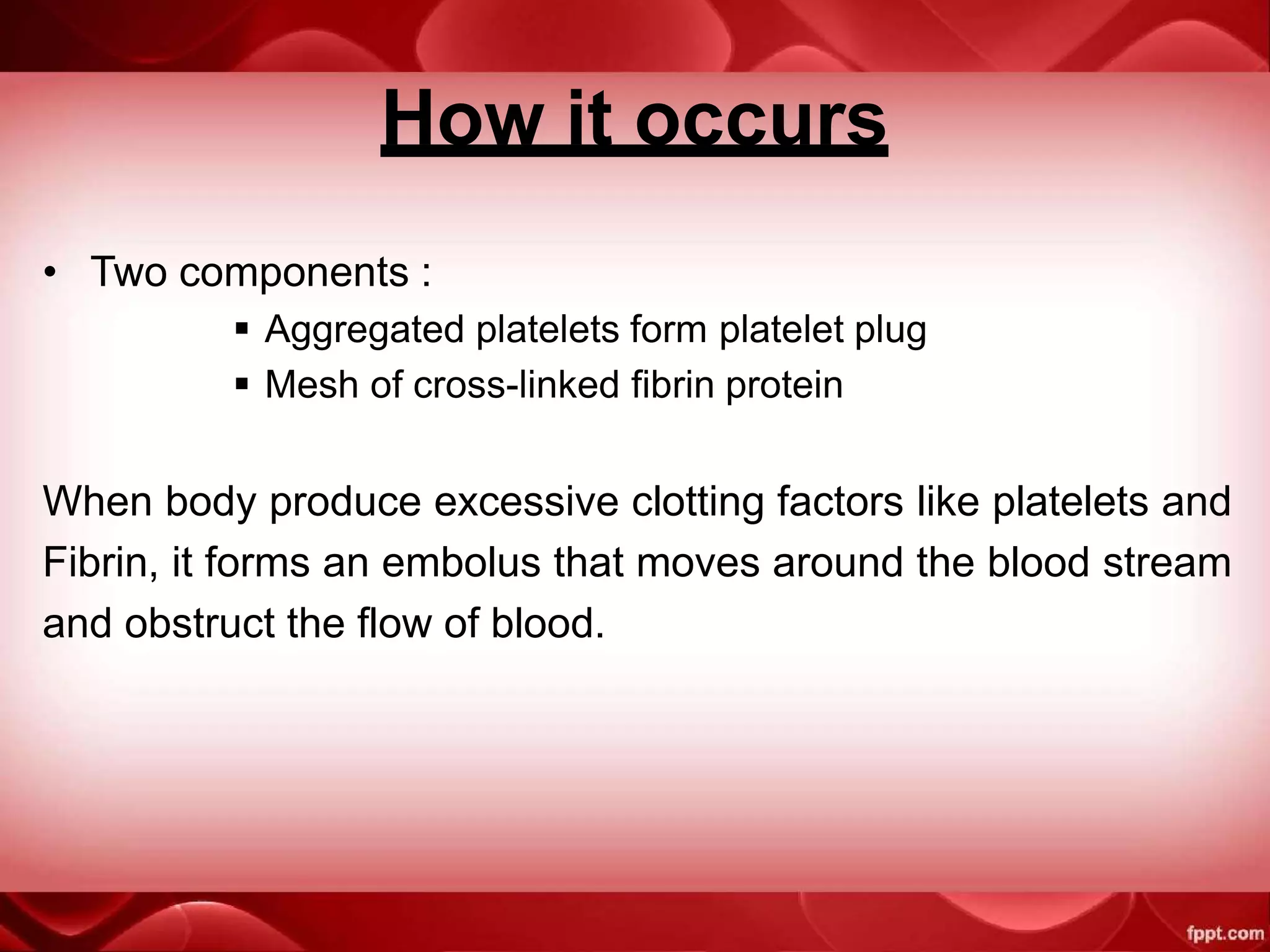 thrombosis.pptx