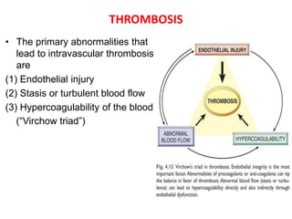 thrombosis.pptx