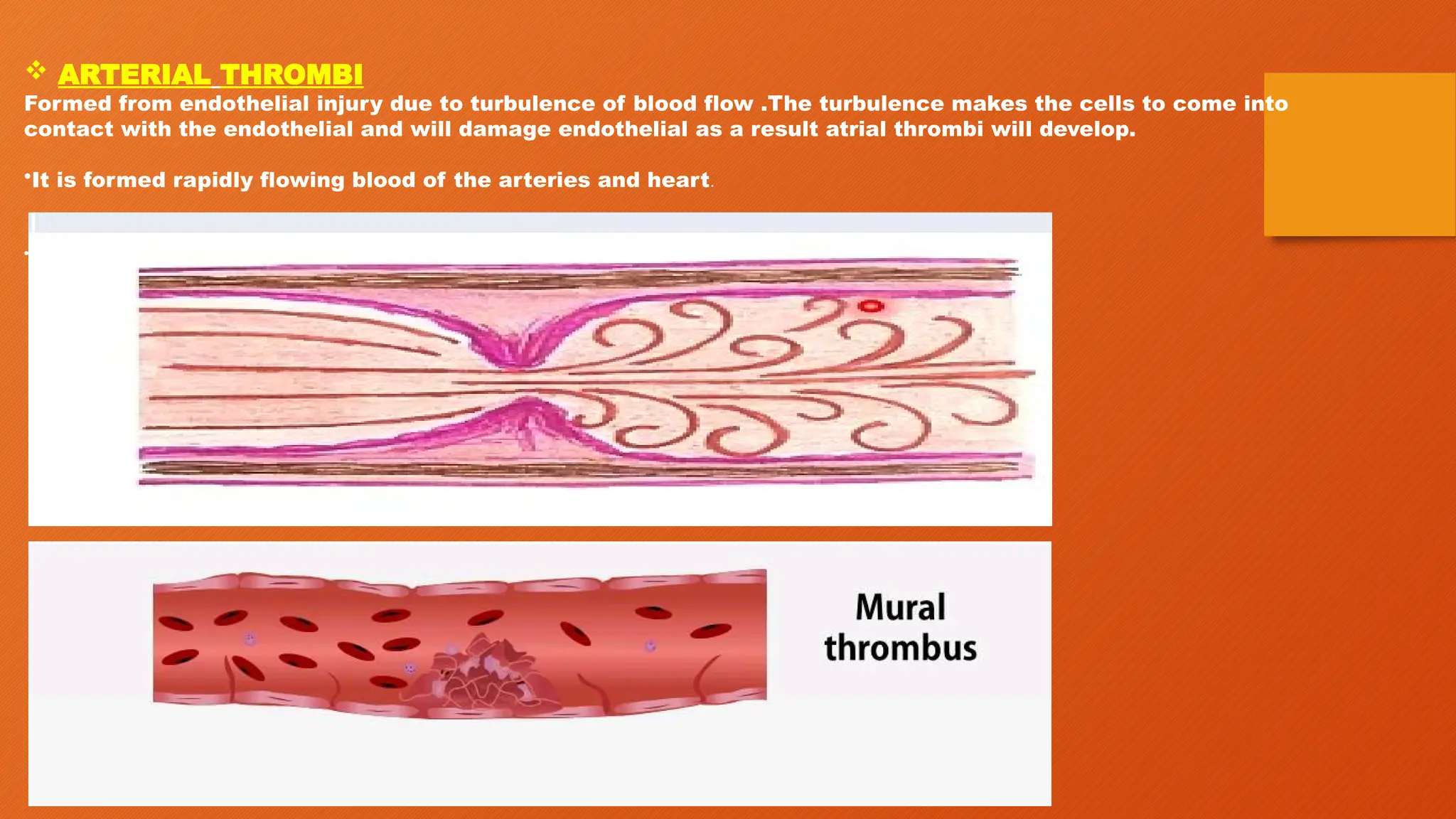 THROMBOSIS ..pptx