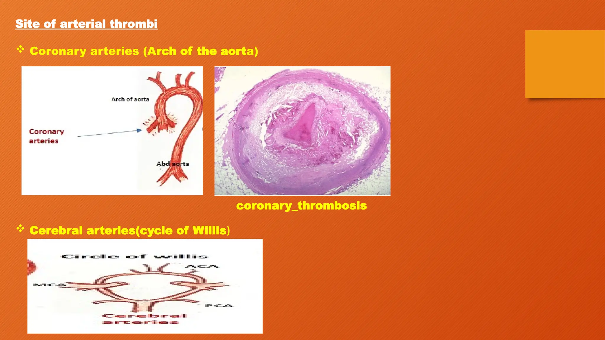 THROMBOSIS ..pptx