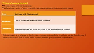 THROMBOSIS ..pptx