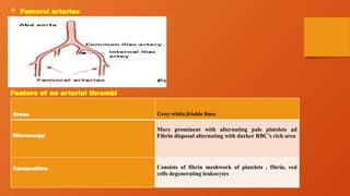 THROMBOSIS ..pptx