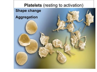 Thrombosis Class05[2] | PPT