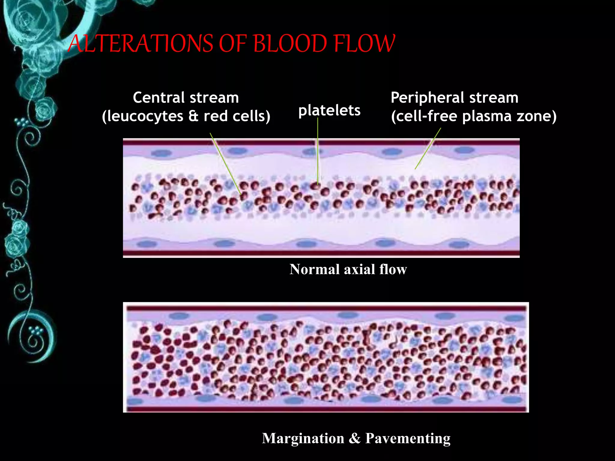 Thrombosis - Pathology by Dr.Pawan | PPTX