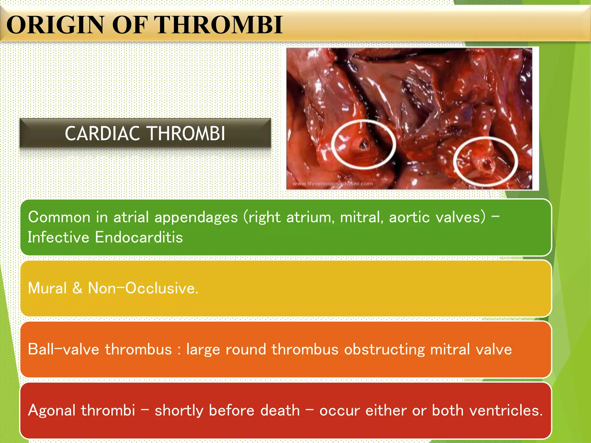 Thrombosis - Pathology by Dr.Pawan | PPTX