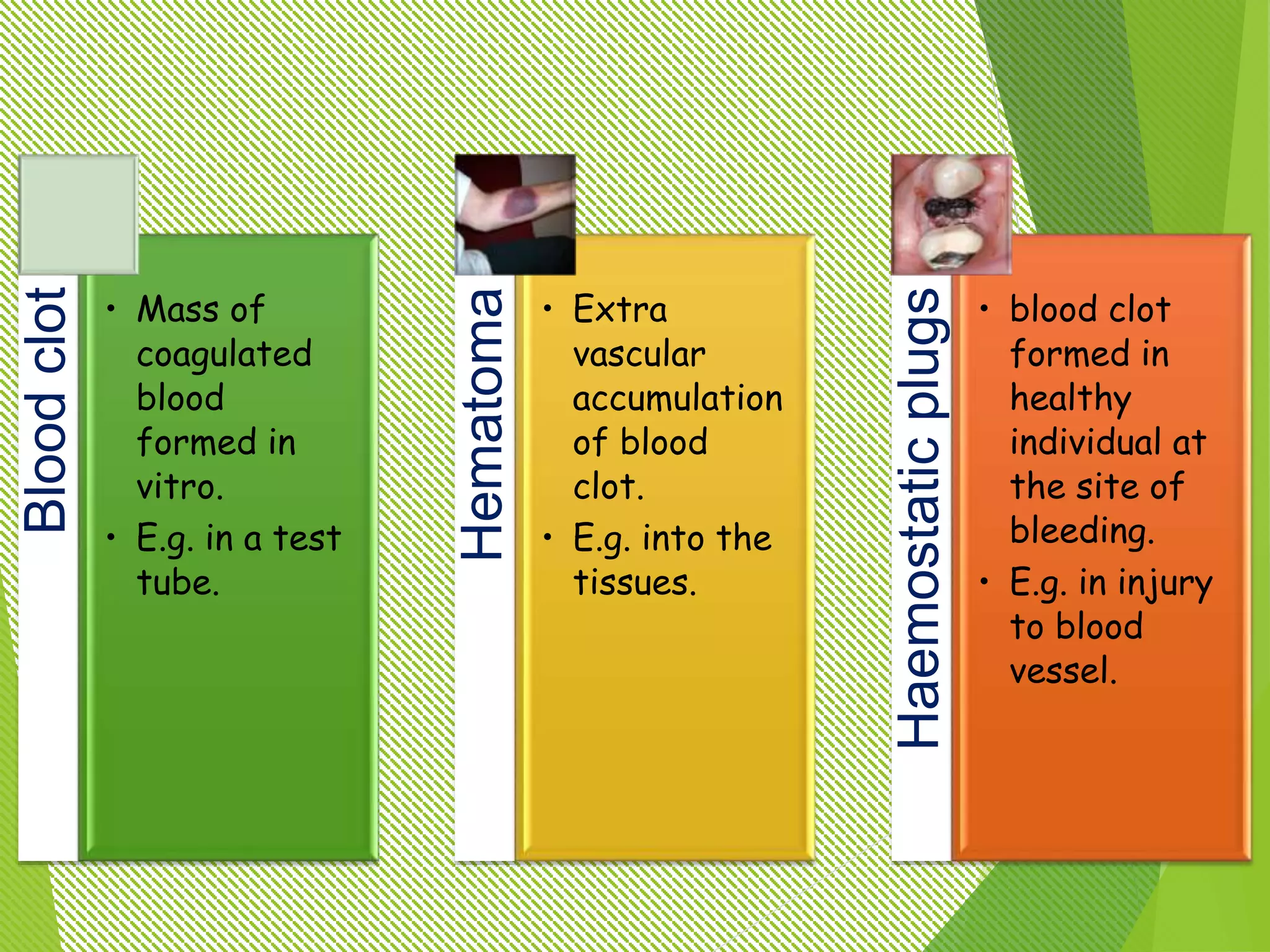 Thrombosis - Pathology by Dr.Pawan | PPTX