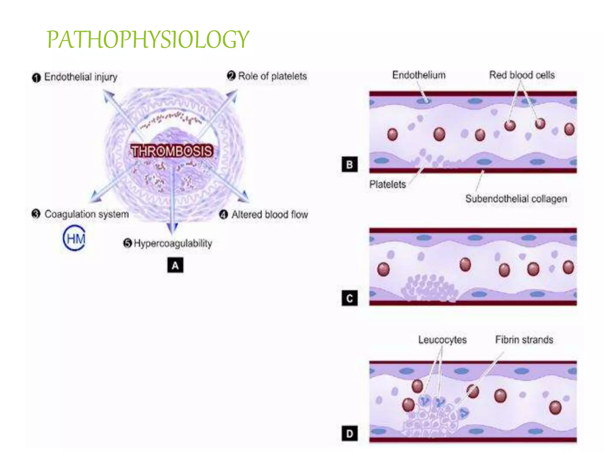 Thrombosis - Pathology by Dr.Pawan | PPTX