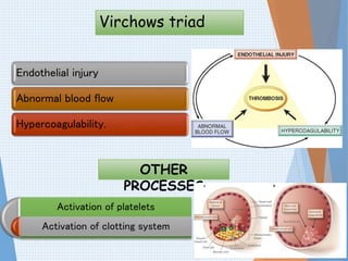 Thrombosis - Pathology by Dr.Pawan | PPTX