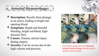 Thrombosis, EDEMA.pptx general pathology | PPTX
