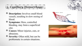 Thrombosis, EDEMA.pptx general pathology | PPTX