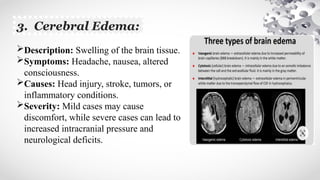 Thrombosis, EDEMA.pptx general pathology | PPTX