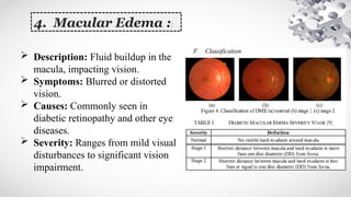 Thrombosis, EDEMA.pptx general pathology | PPTX