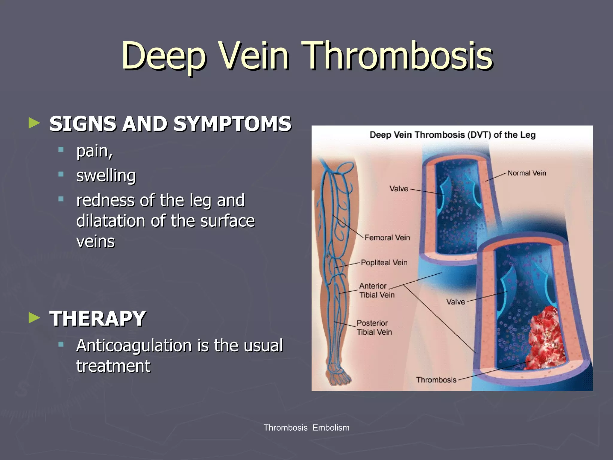 Thrombosis & embolism | PPT