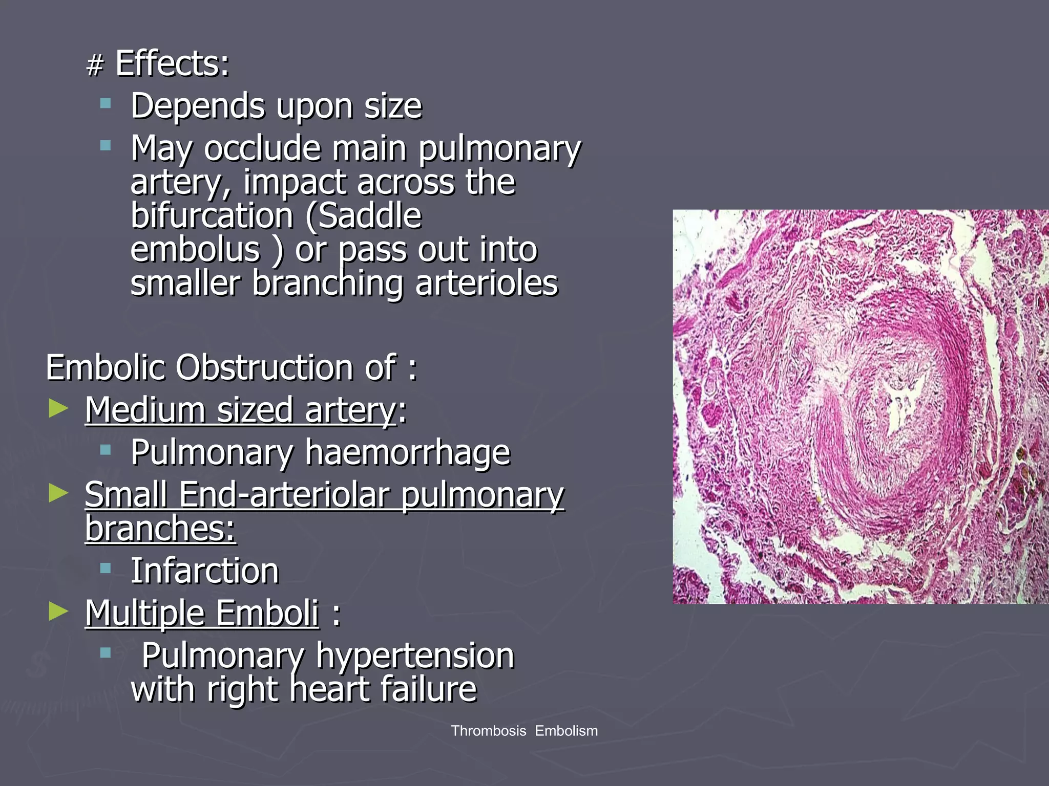 Thrombosis & embolism | PPT
