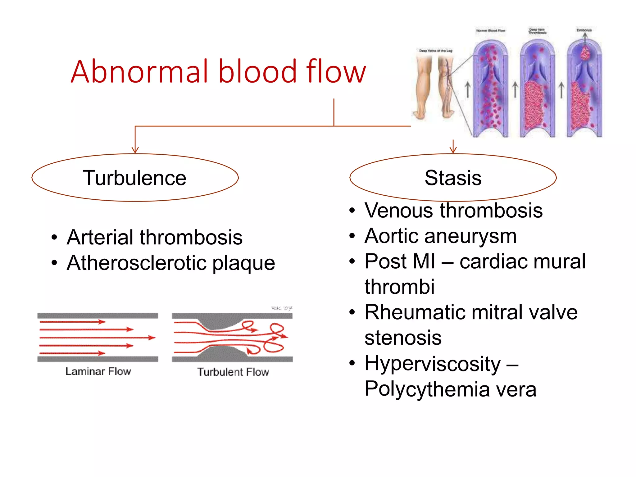 thrombosis embolism.pptx