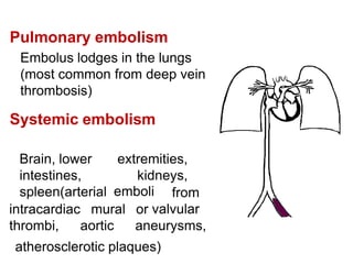 thrombosis embolism.pptx