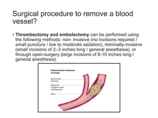thrombosis embolism.pptx