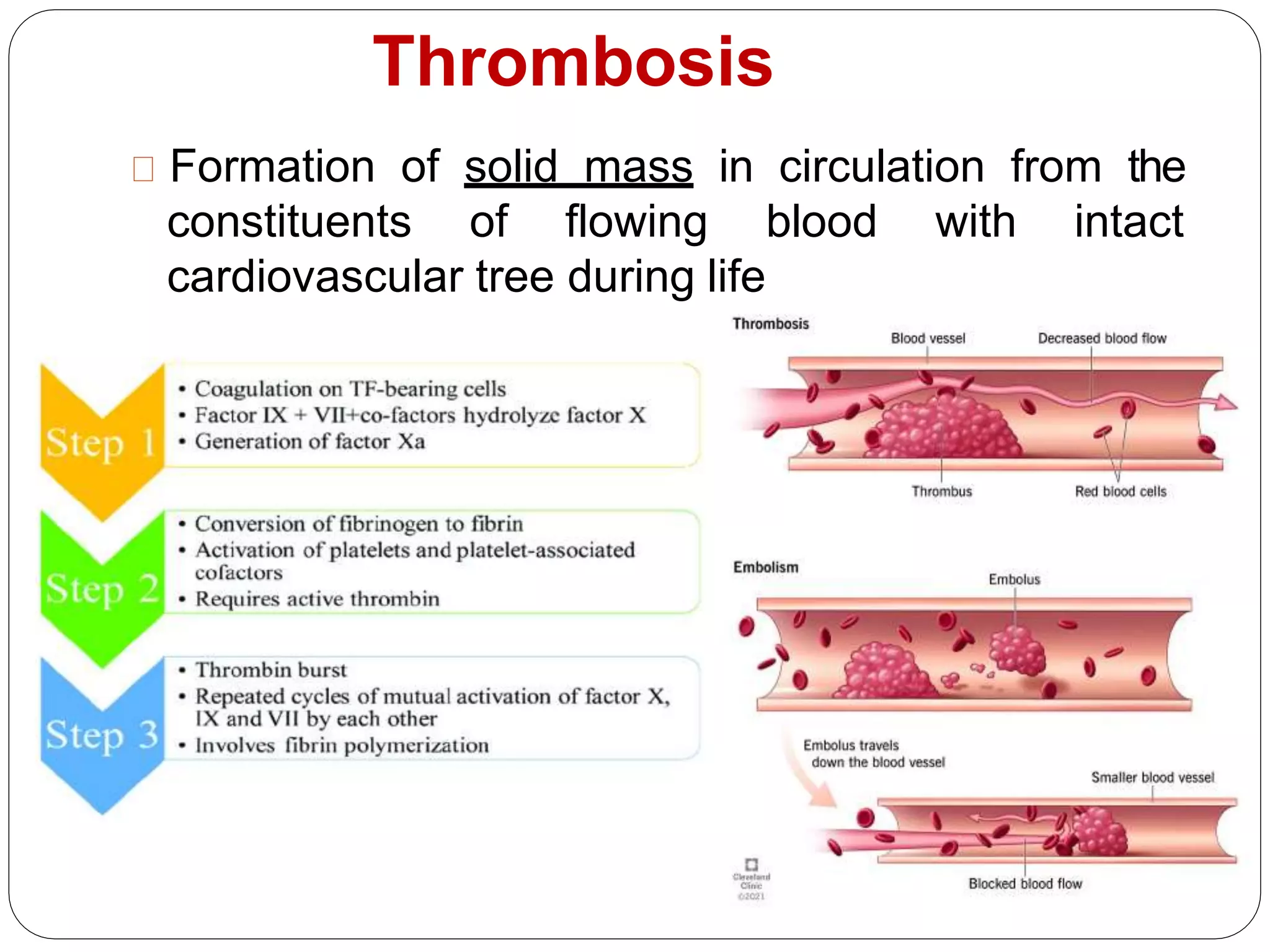 thrombosisembolismandinfarction-180117180555.pptx