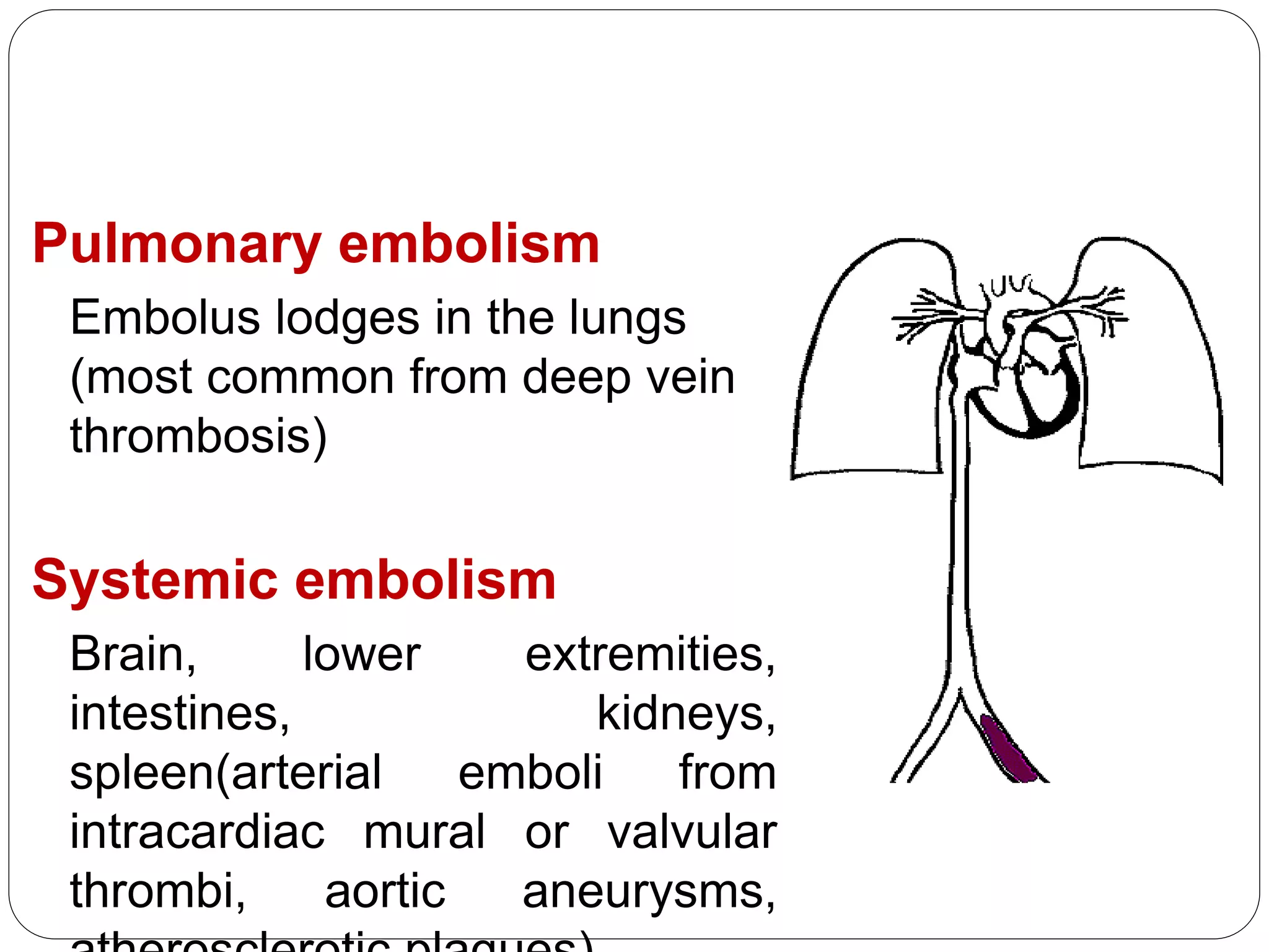 Thrombosis, embolism and infarction | PPTX