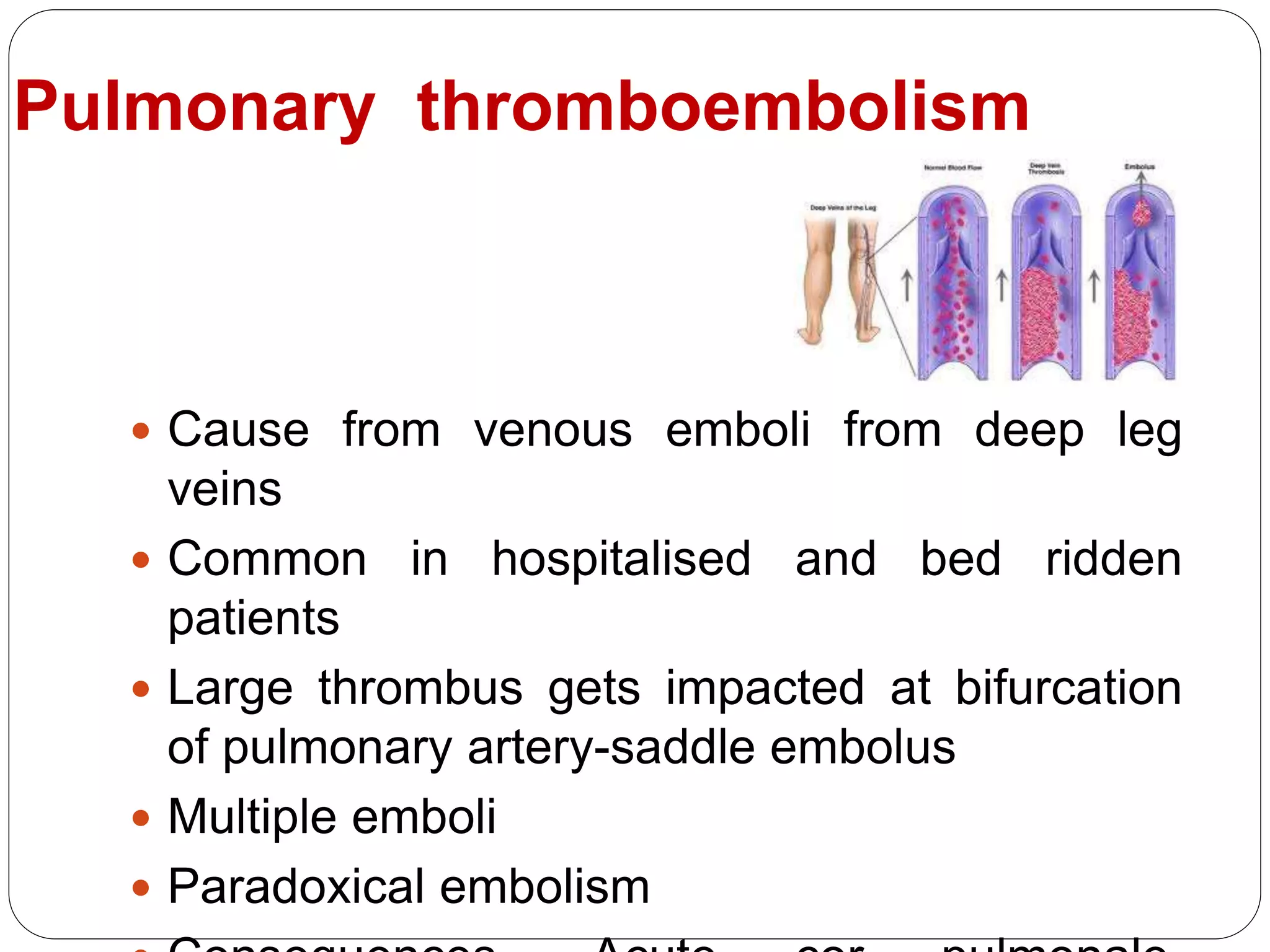 Thrombosis, embolism and infarction | PPTX