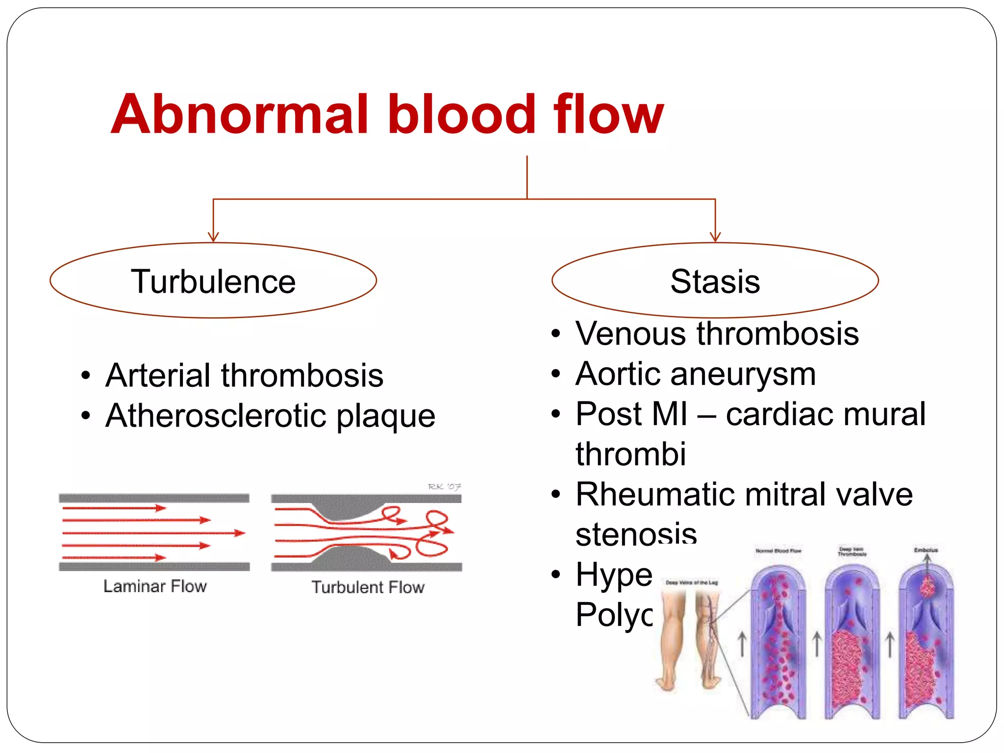 Thrombosis, embolism and infarction | PPTX