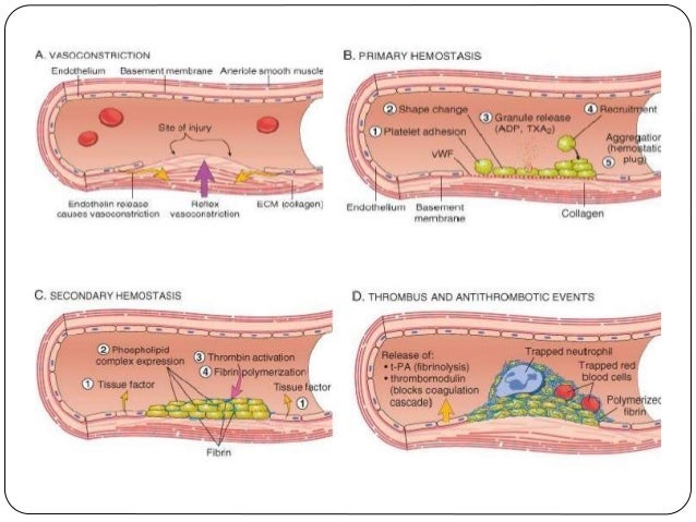 Thrombosis, embolism and infarction