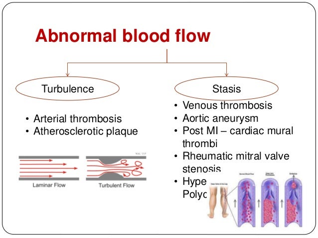 Thrombosis Embolism And Infarction