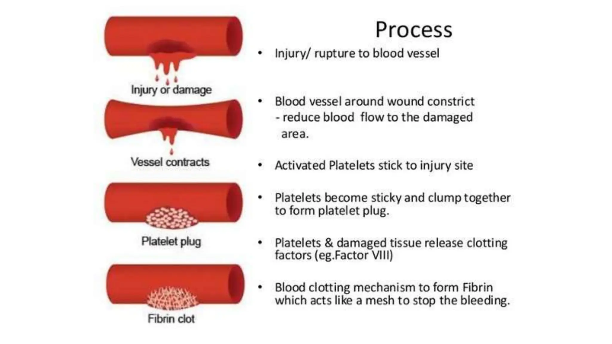 THROMBOSIS, PHLEBITIS, PHLEBOTHROMBOSIS.pptx