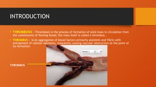 THROMBOSIS PRESENTATION G4 copy. . pptx | PPT