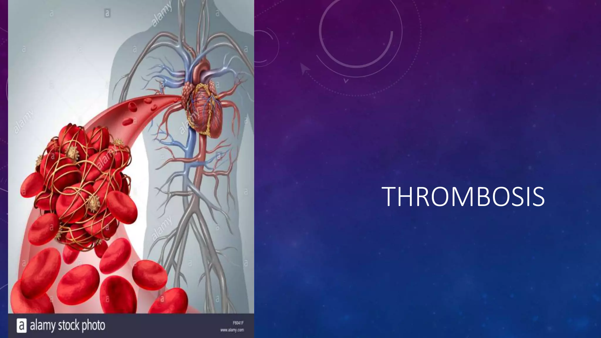 History of thrombosis | PPTX | Blood Disorders | Diseases and Conditions