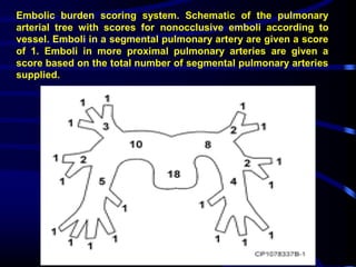 Thrombotic and nonthrombotic pulmonary embolism | PPT