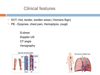 Thrombotic complications in ibd | PPT