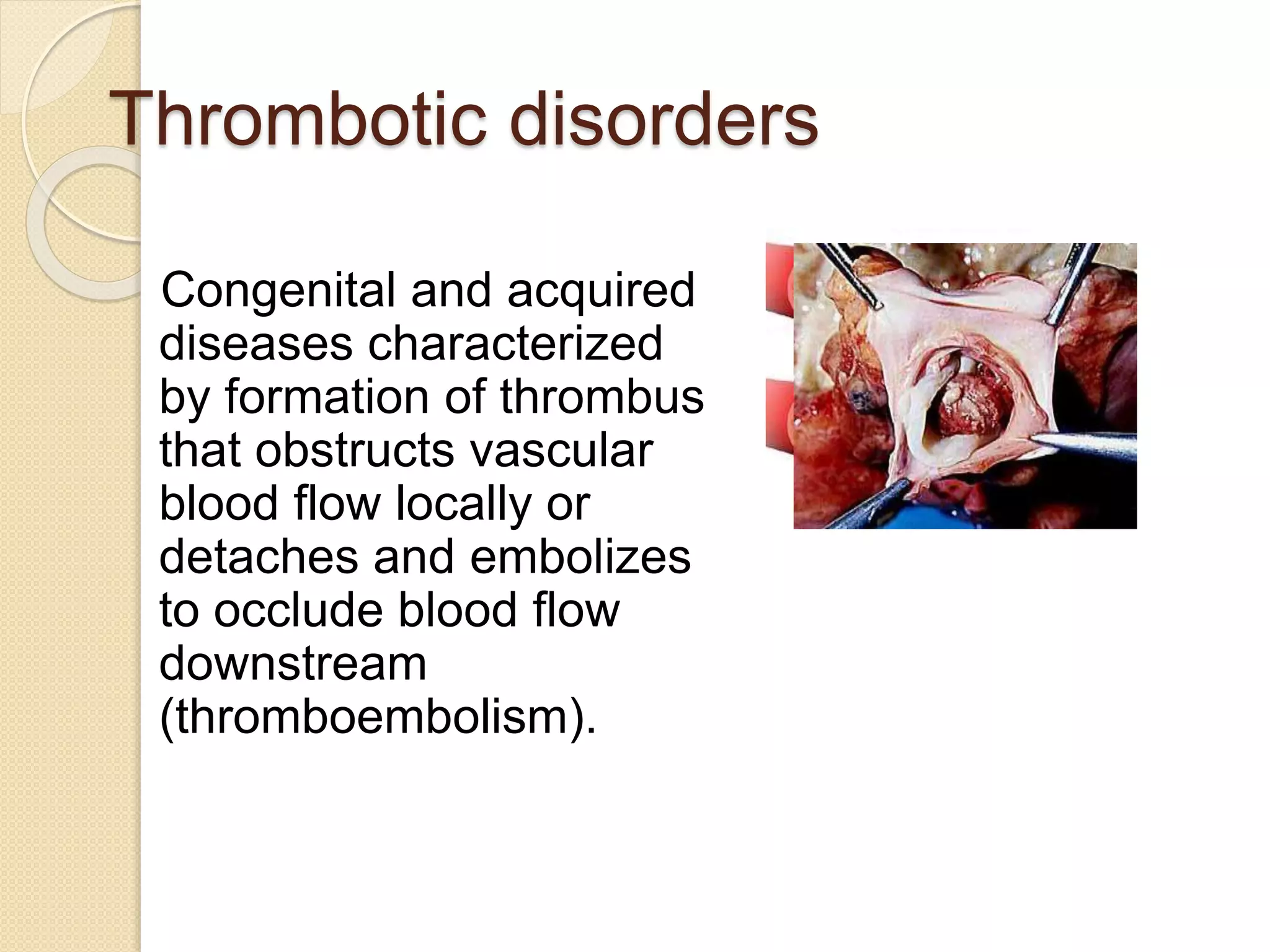 Thrombotic disorders | PPTX