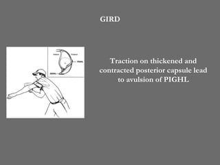 Thrower's shoulder ppt | PPT