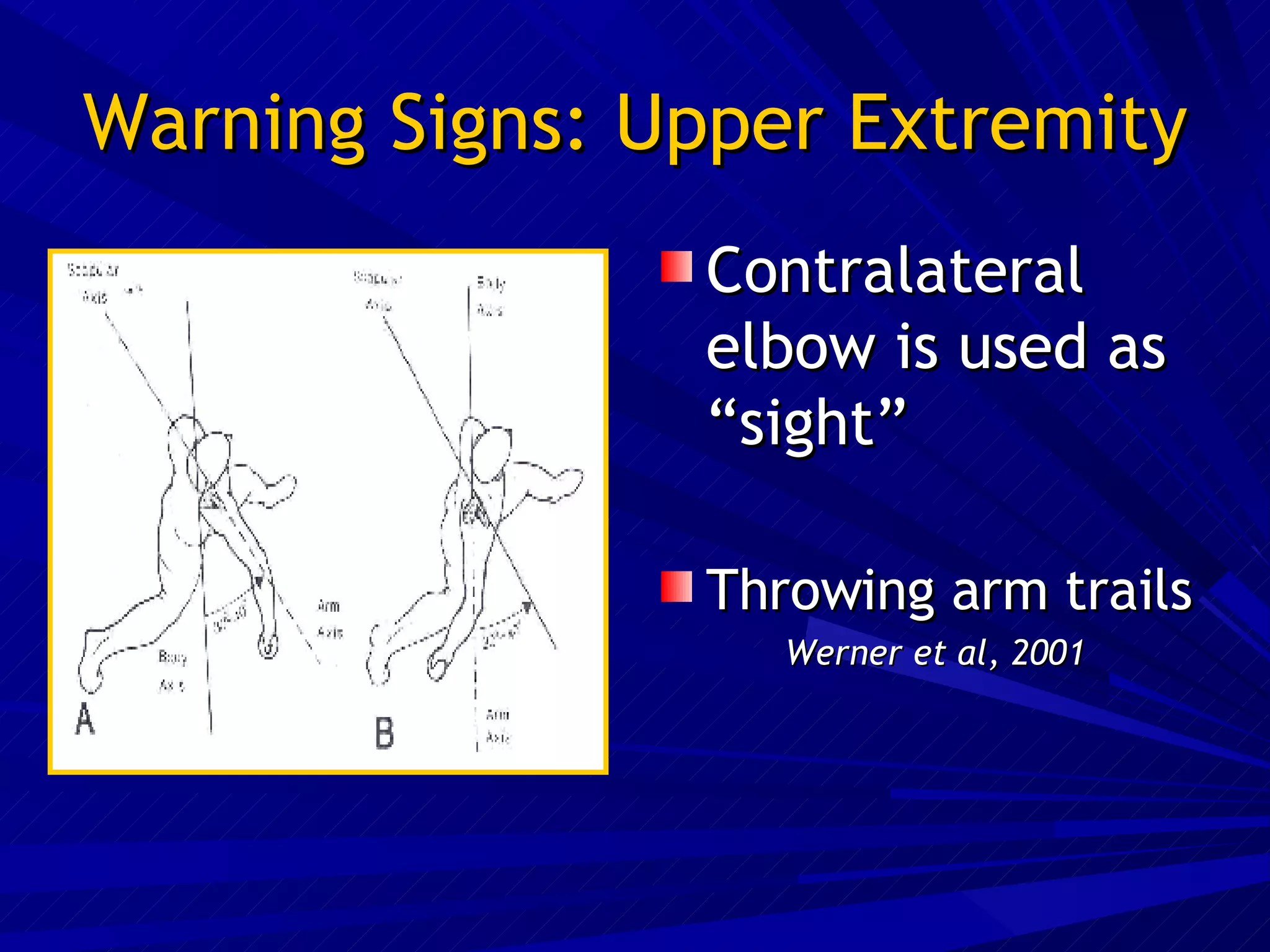 Throwing Athlete | PPT