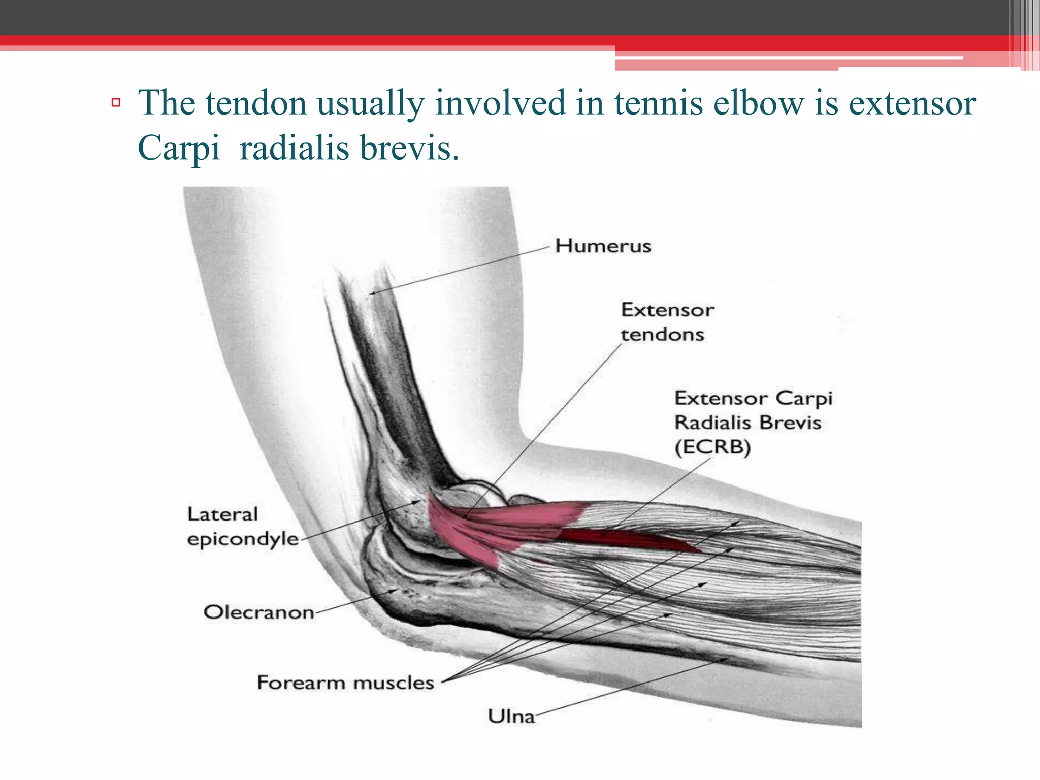 THROWING INJURIES OF UPPER LIMB - MANOJ PRASATH | PPTX