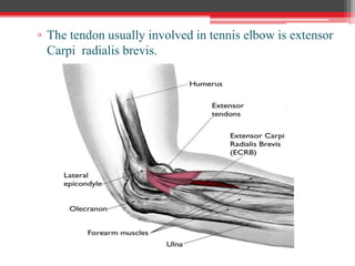 THROWING INJURIES OF UPPER LIMB - MANOJ PRASATH | PPTX