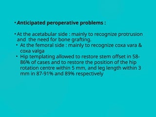 Pre op templating of Total hip replacement | PPTX