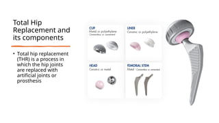 Templating in Total Hip Arthroplasty / Replacement | PPTX