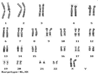 Ths general biology unit 4 heredity karyotyping notes_v1516 | PPT