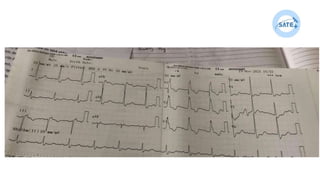 Thực-hành-đọc-ECG-4fgahaheyehdg.pptx