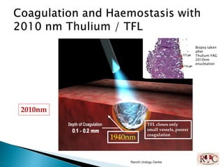 Thulium what'snew | PPTX