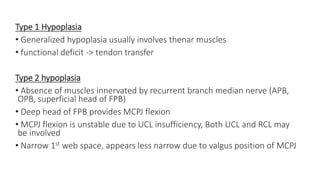 Congenital Thumb Deformities | PPTX